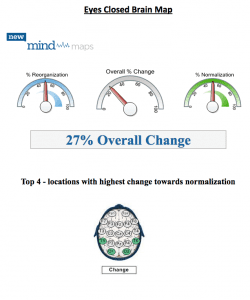 QEEG Brain Scan Results - Lisa Gumieniuk